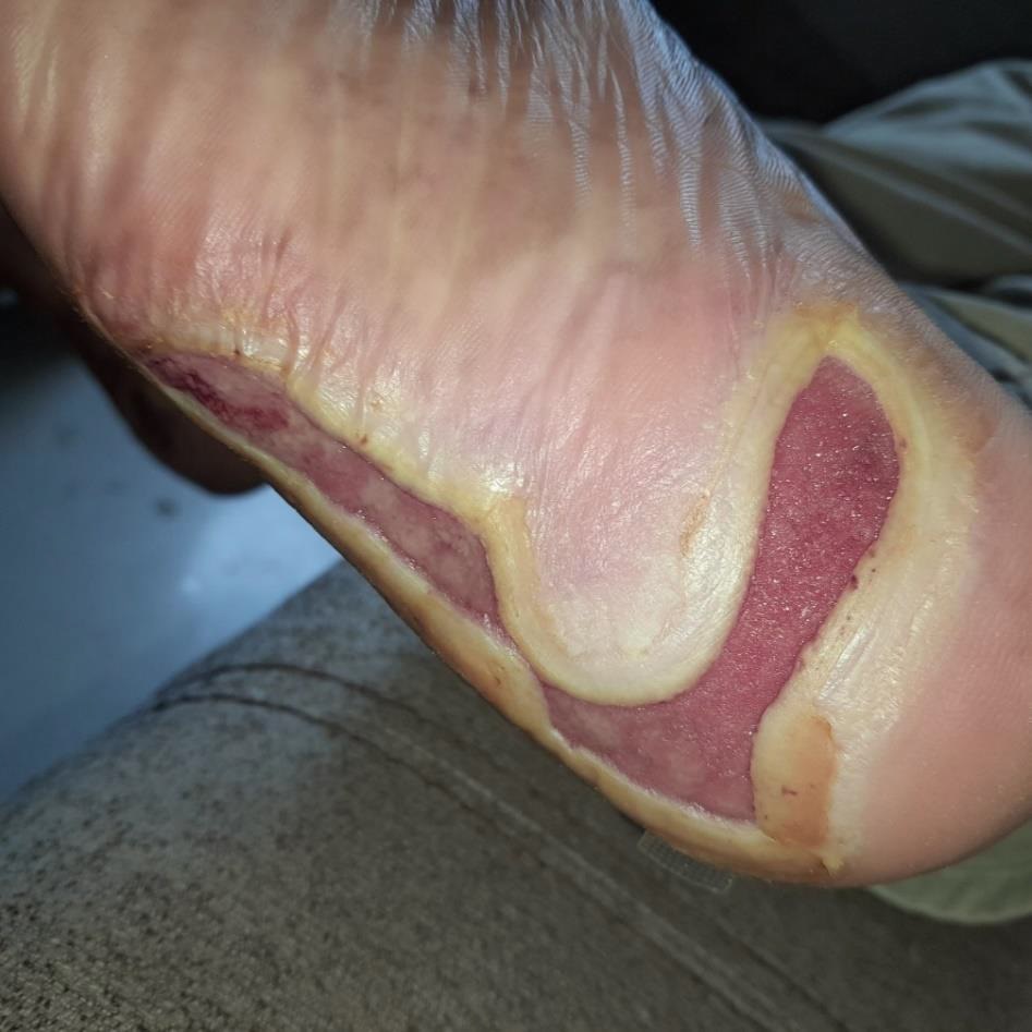 H-Apyzil » 5ª Evaluacion